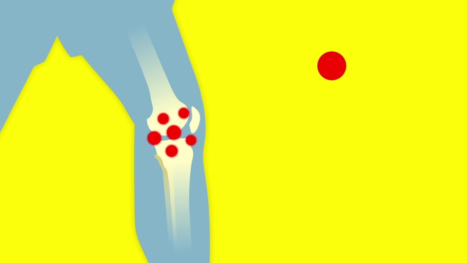 Advil (2 Vials of 10 Tablets) Pain Reliever / Fever Reducer Coated ...